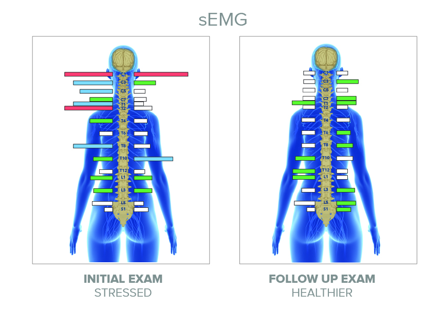 Vitality Wellness Network Chiropractic Care Redmond WA